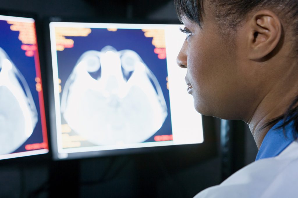 New PET Scan For Early Diagnosis of Parkinson’s – Bluegrass Regional ...