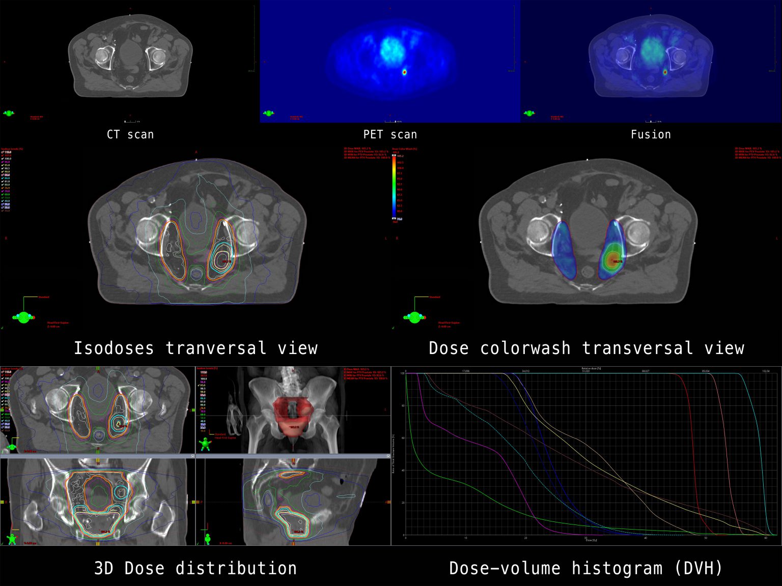 Bluegrass Regional Imaging